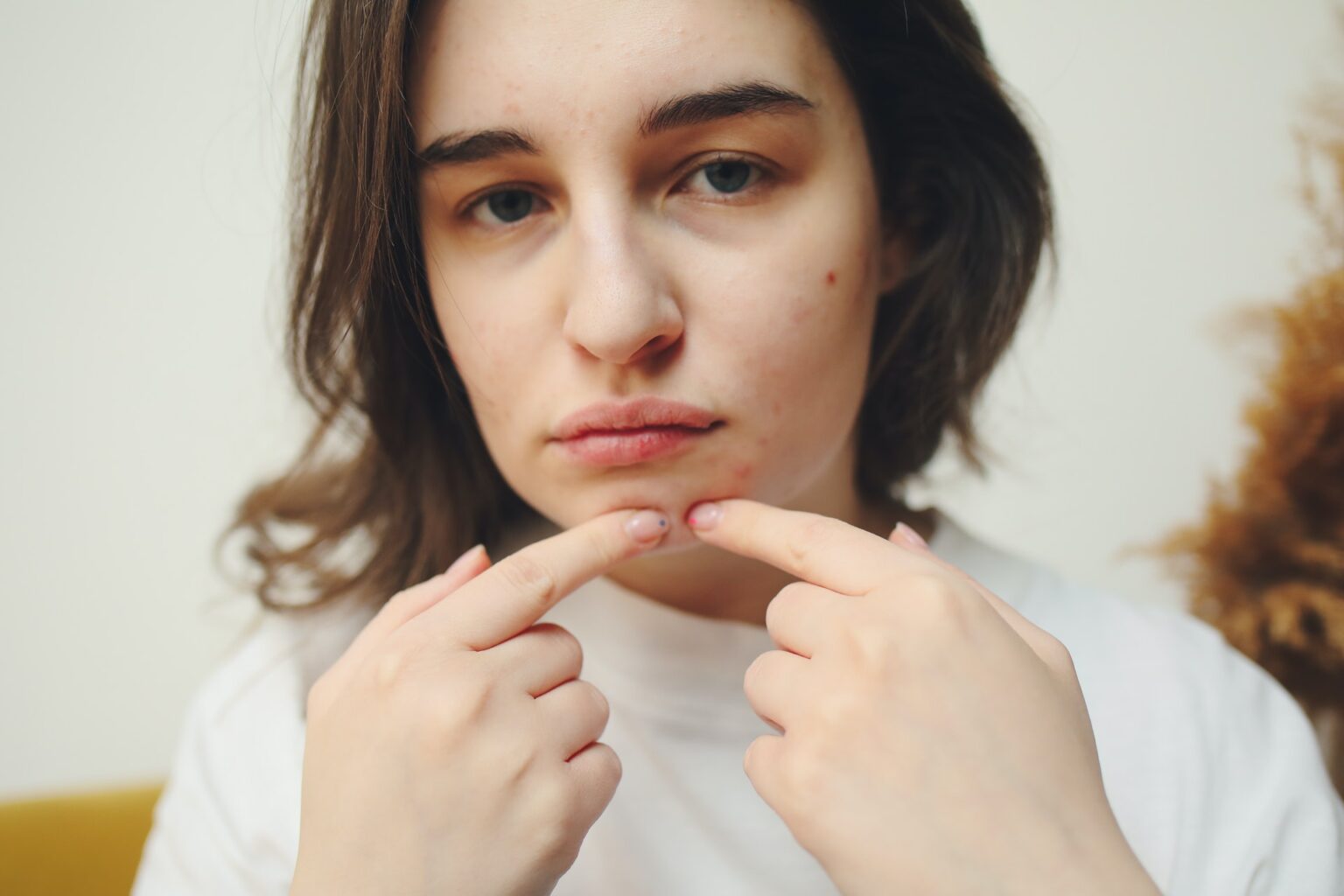 Common Skin Conditions - Acne, Eczema & Psoriasis Treatments | GraceMed